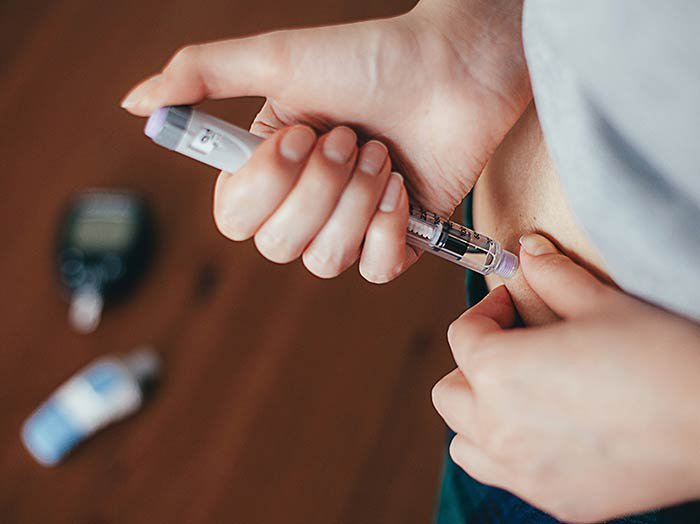 آمپول ملیتاید (Melitide) برای درمان چاقی » دکتر علیرضا مهربان - فوق ...